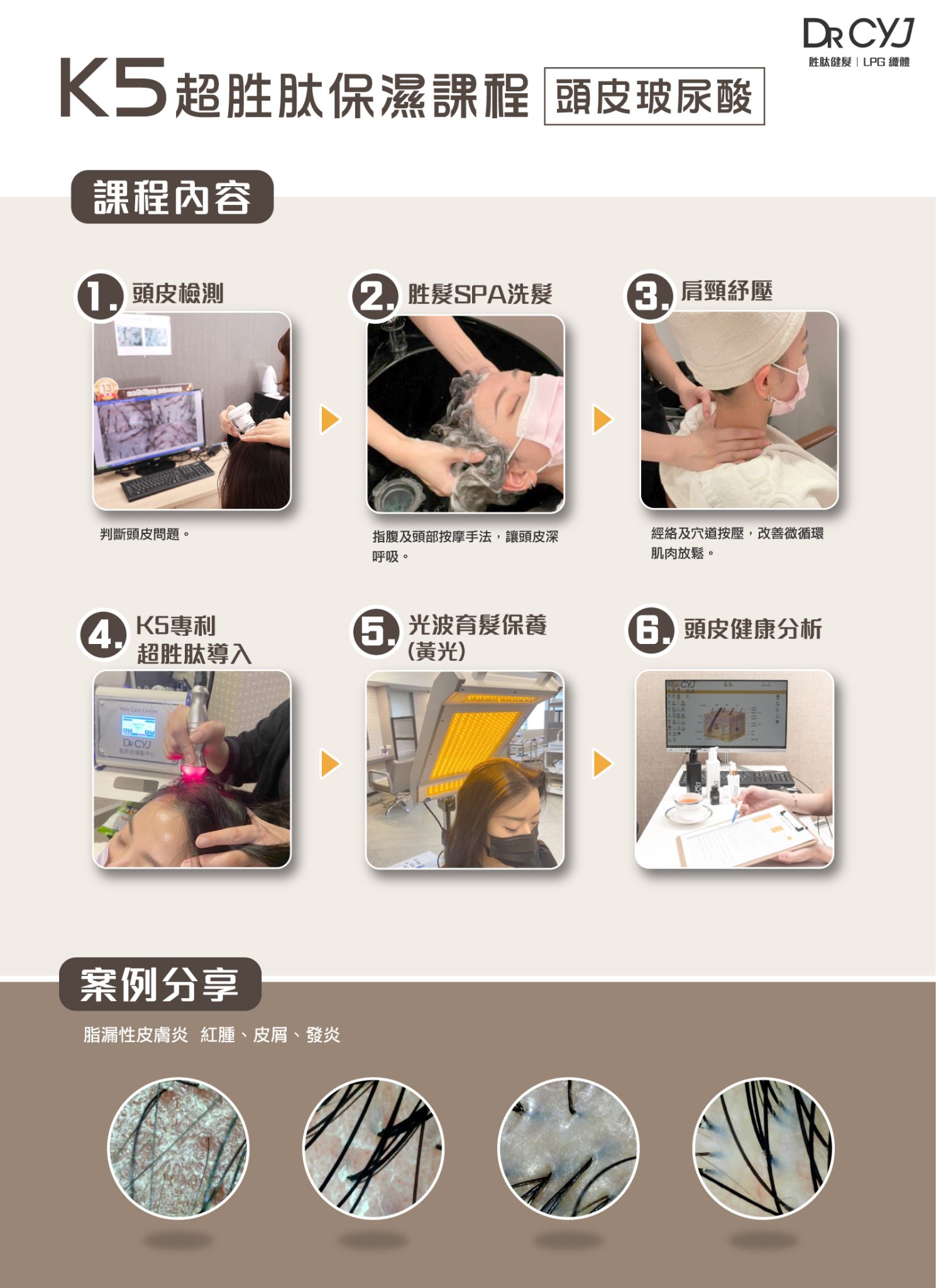 超胜肽胜髮課程K5 - DR CYJ髮胜肽健髮中心